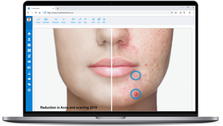 Dermatology EHR and Practice Management Software | ChartPerfect
