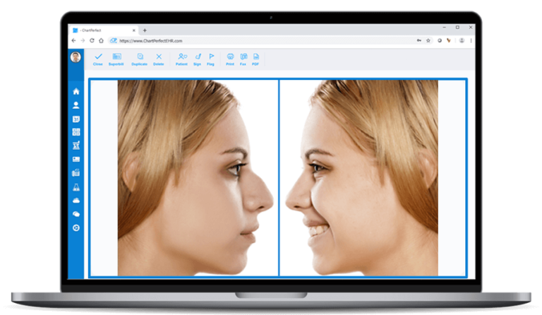 EHR and Practice Management Platform for Plastic Surgery | ChartPerfect